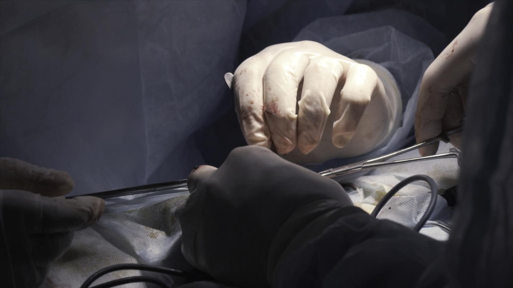 Benefits of Minimally Invasive Surgery for Faster Recovery